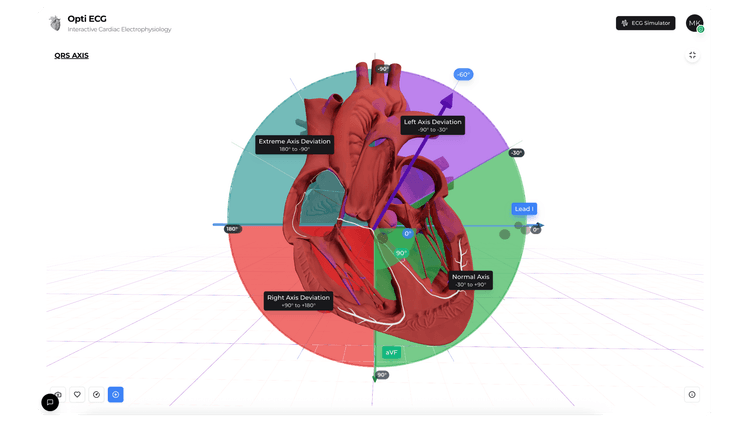Opti ECG - Interactive 3D Cardiac Electrophysiology Learning Platform