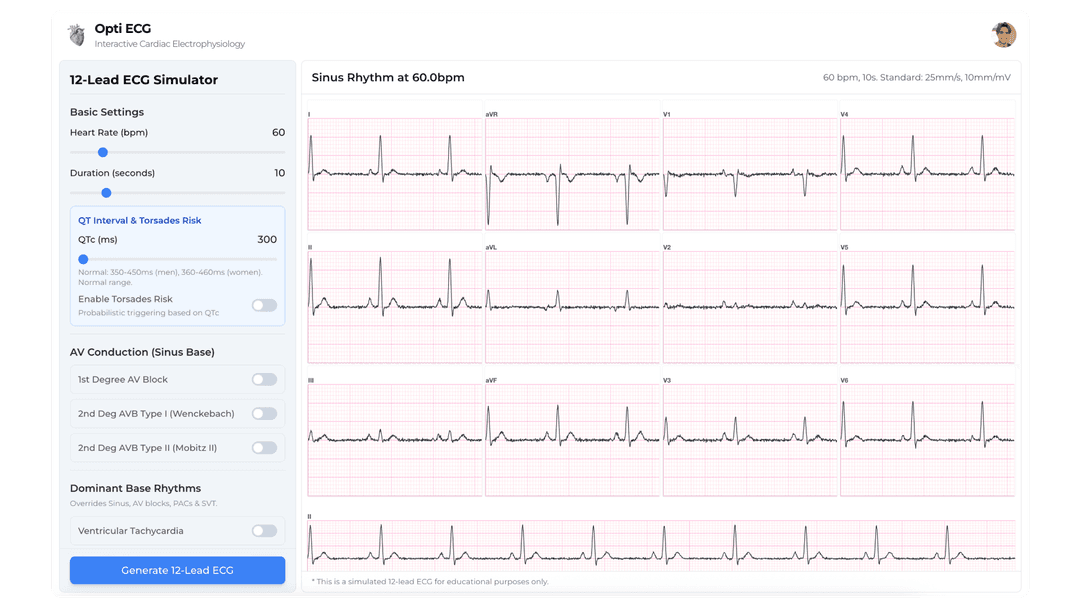 Opti - Front-End for ECG Visualization
