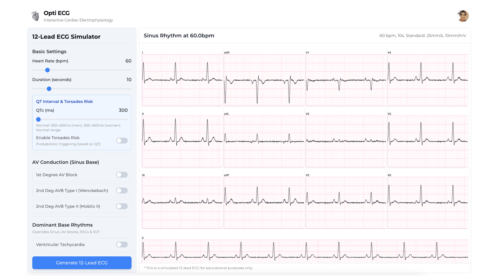 Opti - Front-End for ECG Visualization